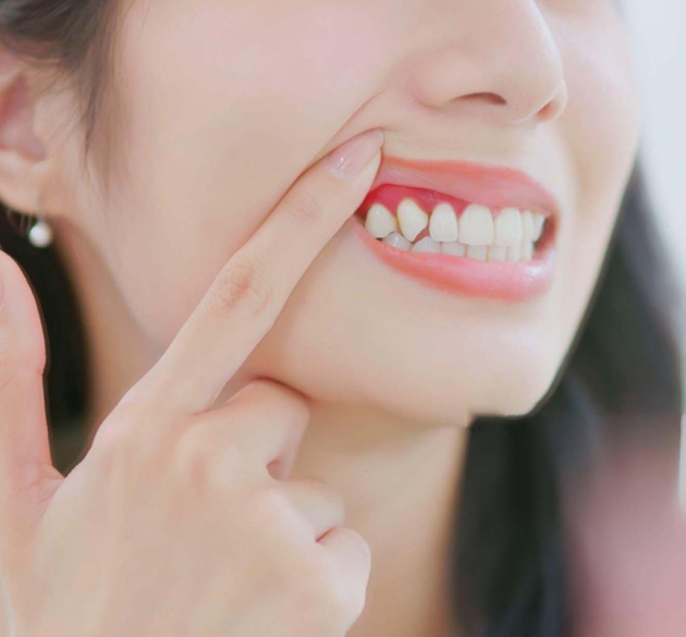 ARESTIN®: Antibiotic for Tooth Infection | Inspired Smiles Family Dental